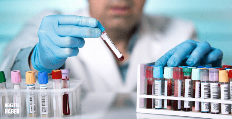 Prokalsitonin Nedir, Kaç Olmalı? PCT Yüksekliği, Düşüklüğü? | Obezite Haber