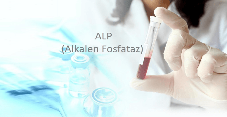 Alkalen Fosfataz (ALP) Nedir? Yüksekliği ve Düşüklüğü | Obezite Haber